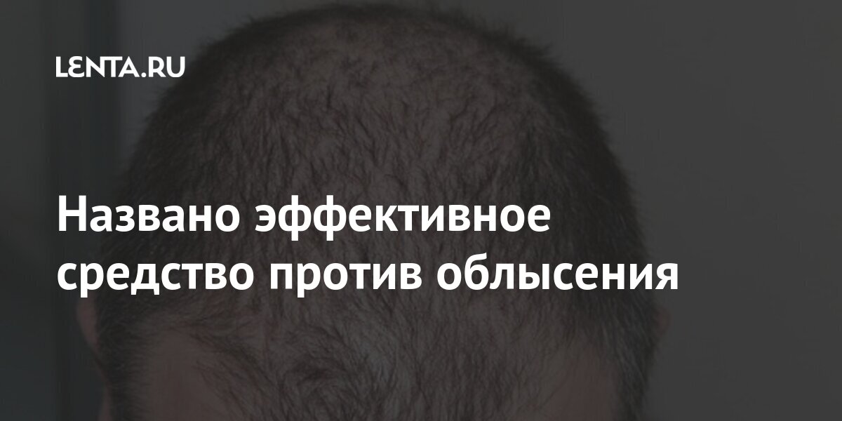 Названо эффективное средство против облысения: Здоровье: Наука и ...