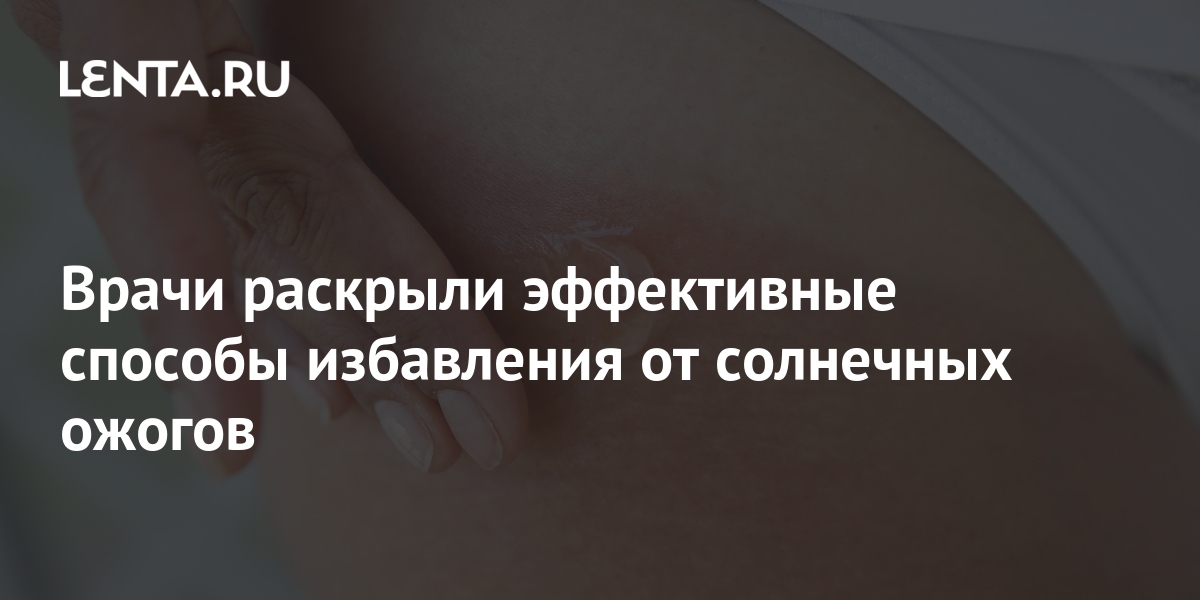 Врачи раскрыли эффективные способы избавления от солнечных ожогов ...