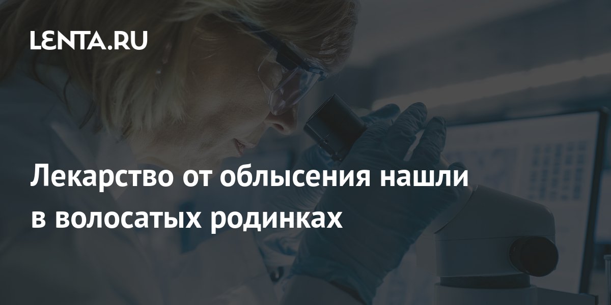 Лекарство от облысения нашли в волосатых родинках: Уход за собой ...