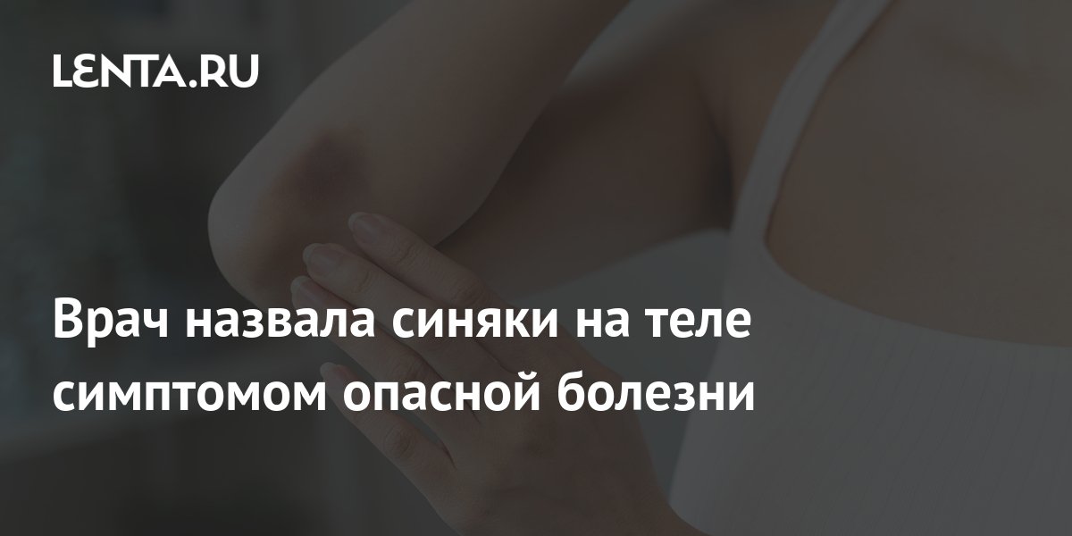 Врач назвала синяки на теле симптомом опасной болезни: Уход за собой ...